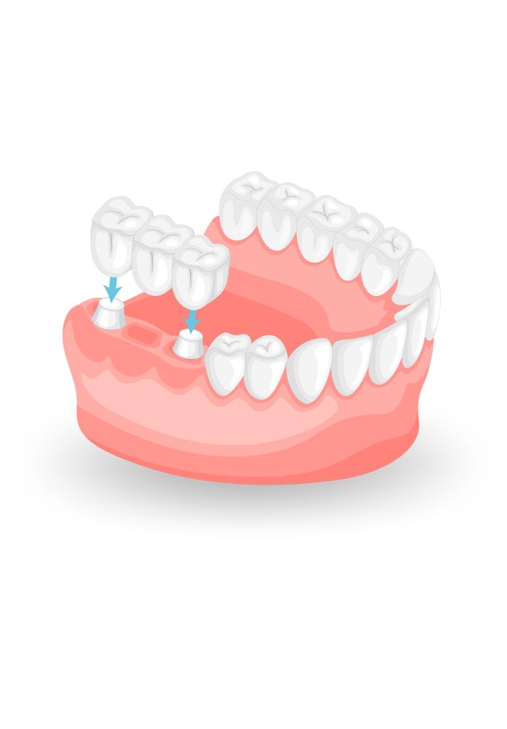 [NEW] Veneers, Crowns & Smile Makeovers - Malmin Dental